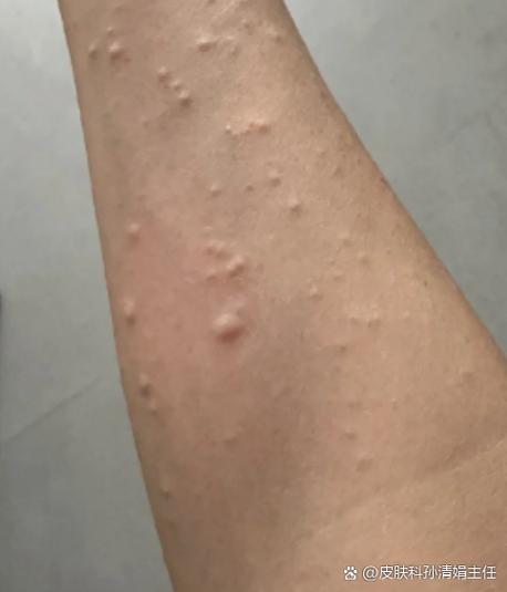 长一片密密麻麻小颗粒图标