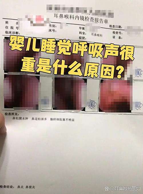 婴儿的呼吸声很重怎么回事图标