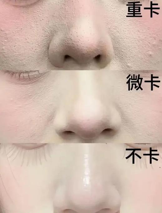 用了粉底液还用粉饼吗图标