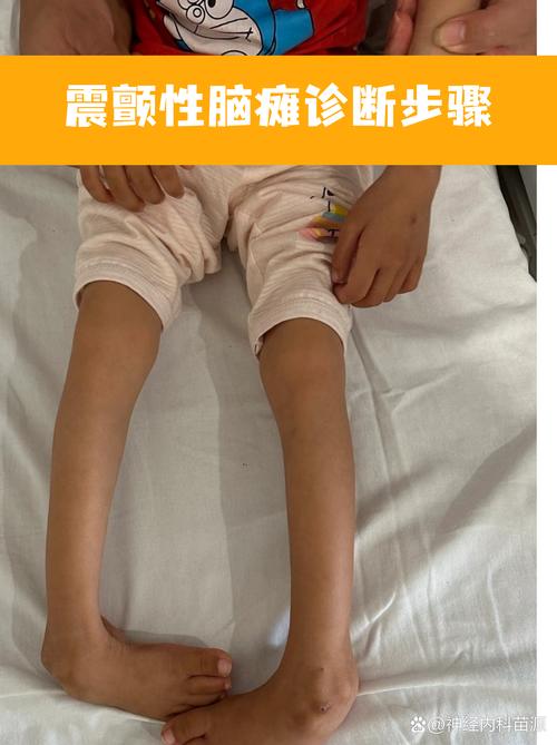 aapnh综合症图标