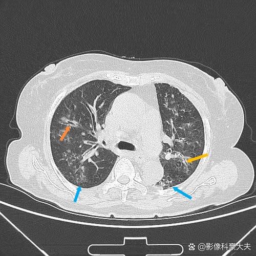 眼珠旁边有褐色斑块图标