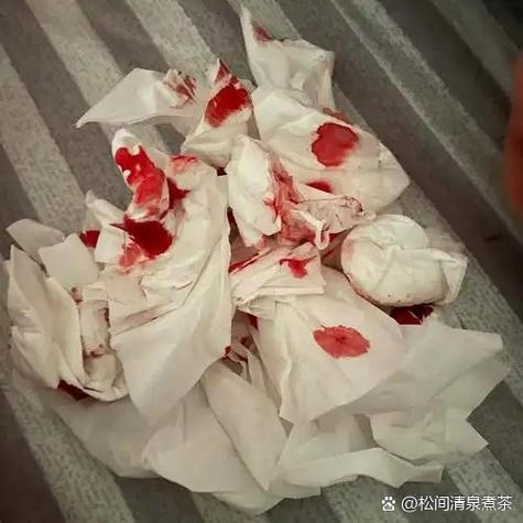 搬家流鼻血截图