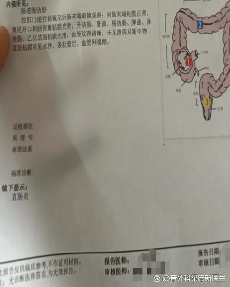 什么是硬分叉截图