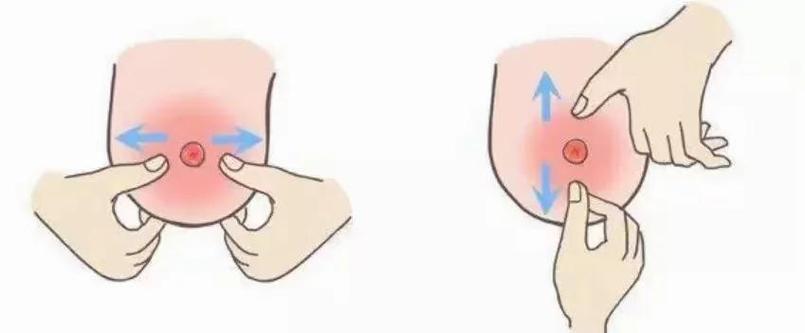 上古卷轴5乳头内陷怎么解决截图