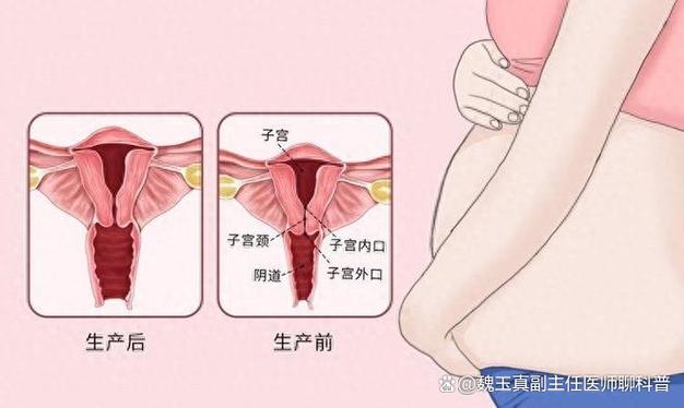 女朋友下面很松弛是什么原因引起的截图