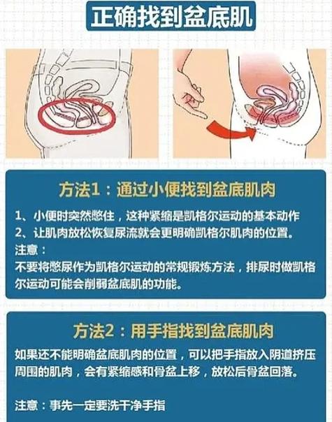 盆底肌怎么恢复训练图标