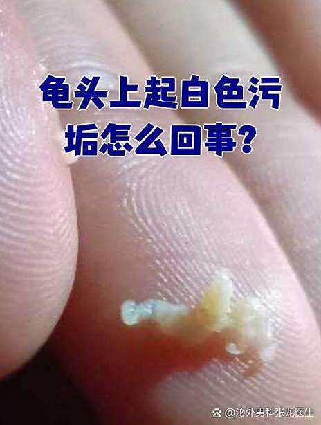 男人龟的头部有白色污垢是什么原因图标