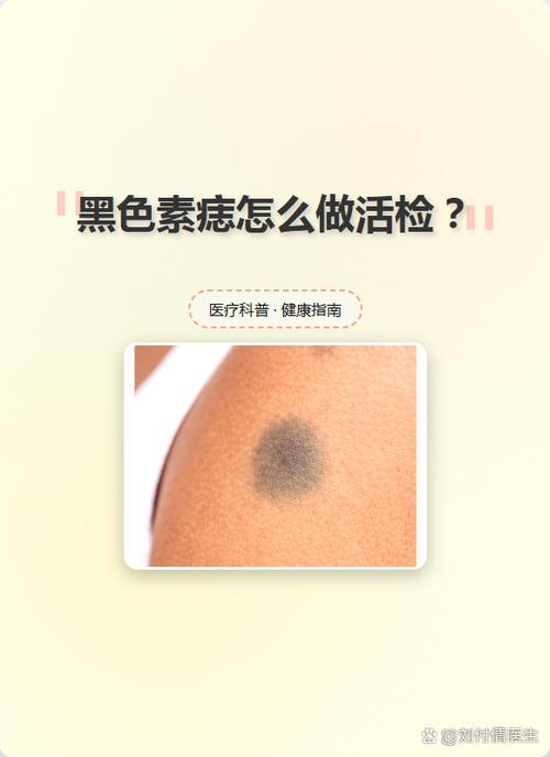 活检意味着什么图标