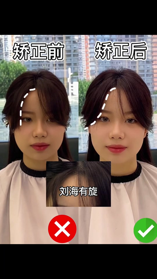 前额头发有旋怎么去掉