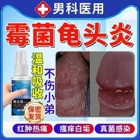 白色念珠菌的克星截图