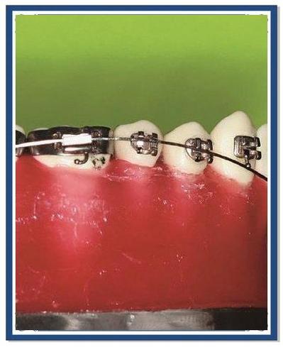 正畸弓制作视频图标