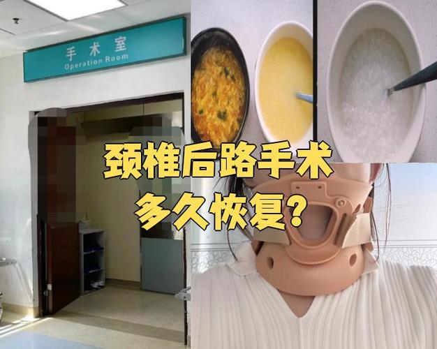 颈椎手术多久能恢复正常图标