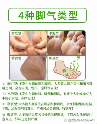 脚足癣图片图标