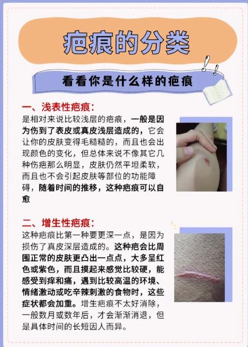 祛除疤痕的有效方法图标
