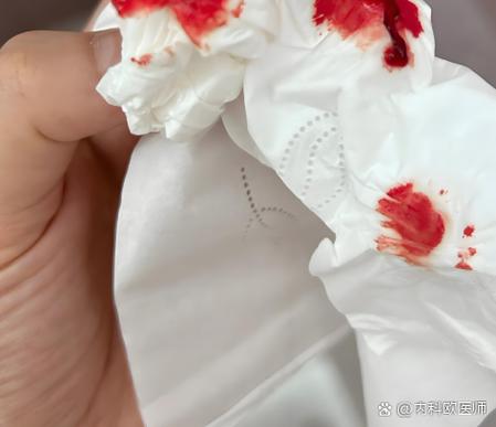 头晕流鼻血是白血病吗截图