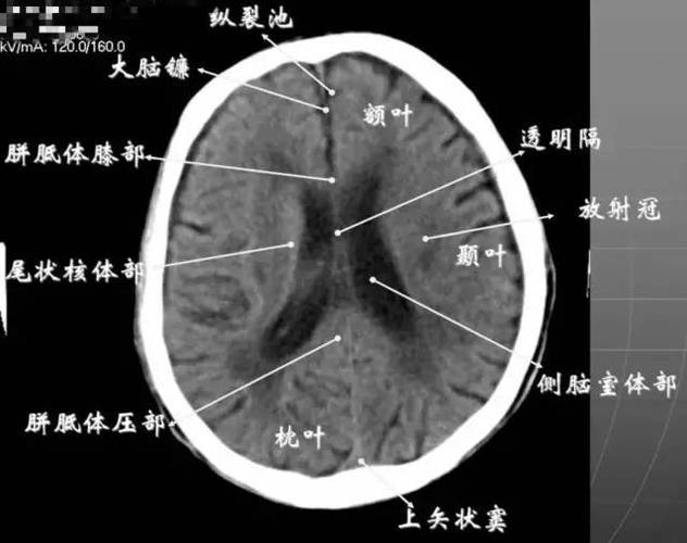 头颅ct检查的目的及意义图标