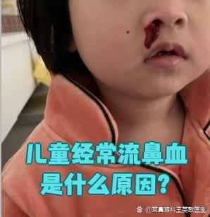 儿童流鼻血皮肤黄截图
