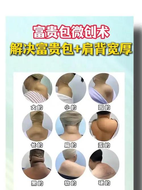 富贵包的形成过程图标