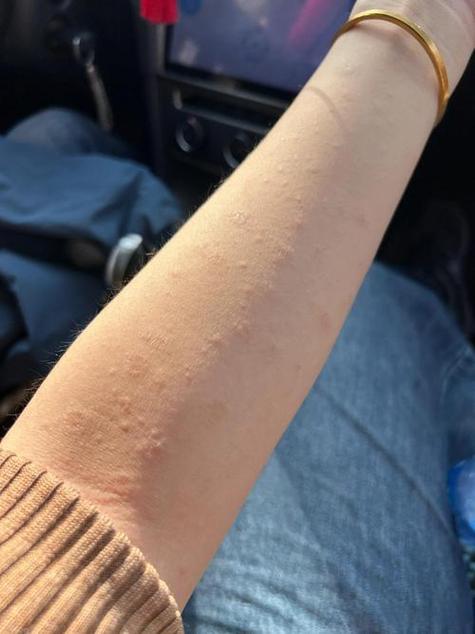 很严重的皮肤病图标