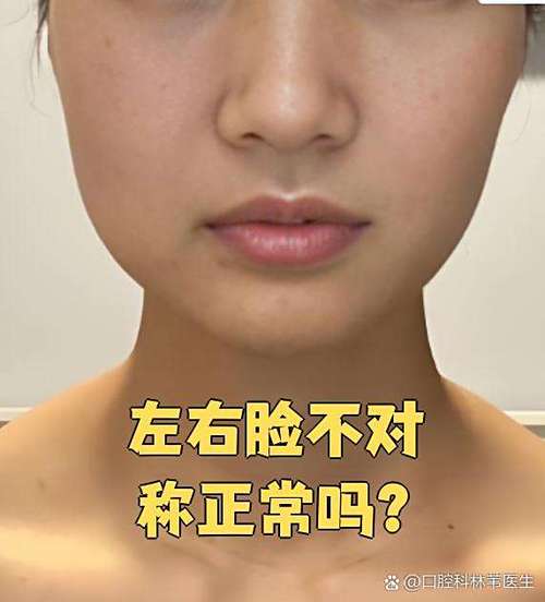 怎么测左右脸对不对称图标