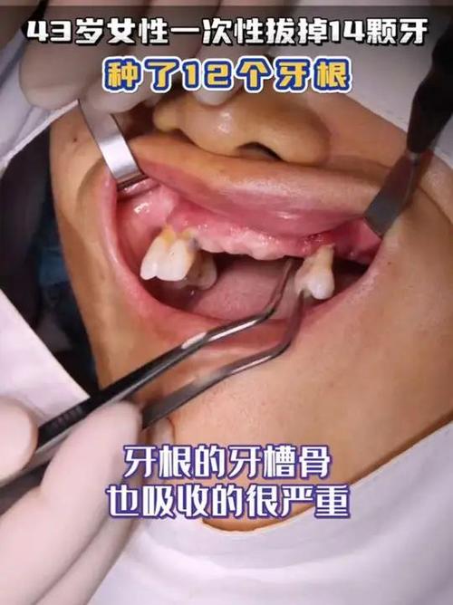 牙齿松动快掉了图标