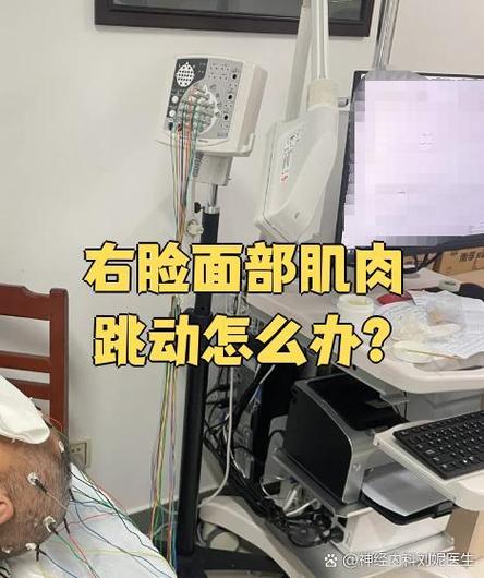 右边脸肌肉时不时跳动截图