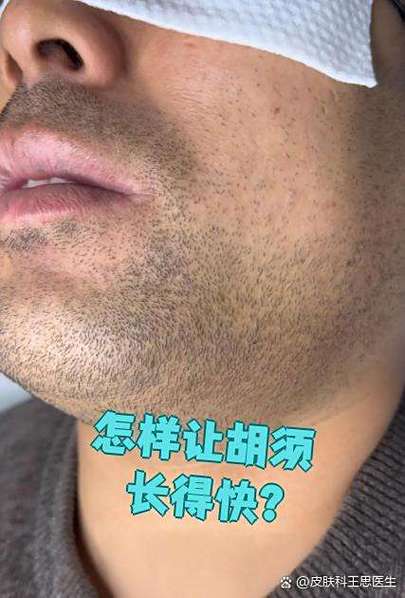 胡子为什么长得快图标