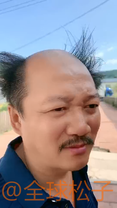 地中海头发截图