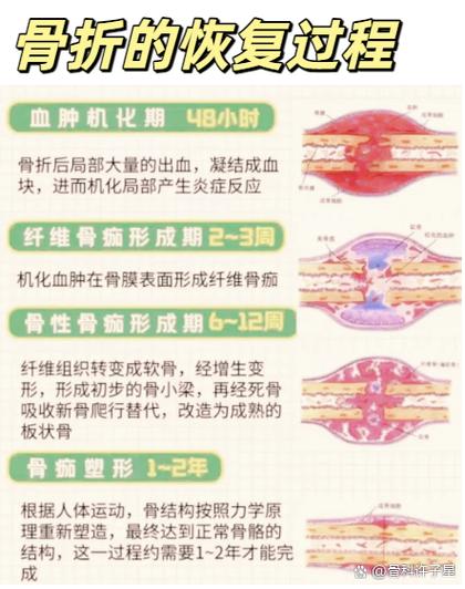 骨折最难熬的三个阶段图标