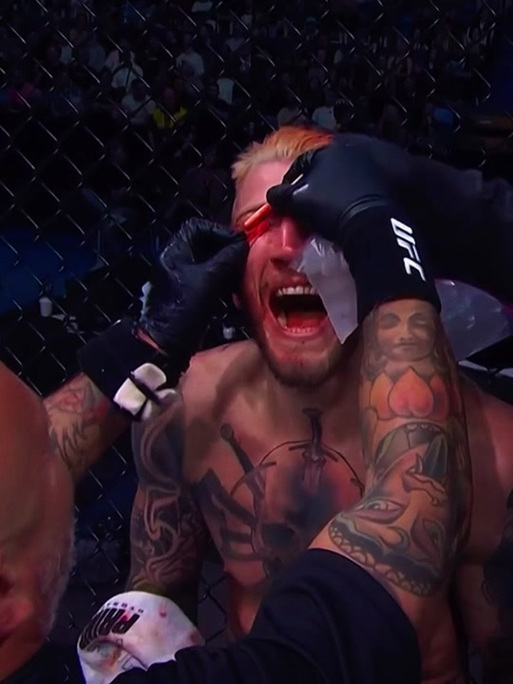 ufc在线观看高清免费图标