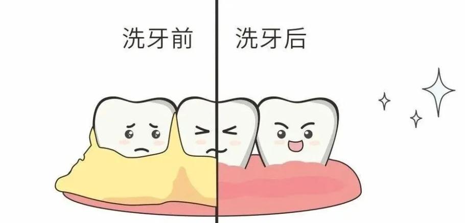 免费洗牙截图