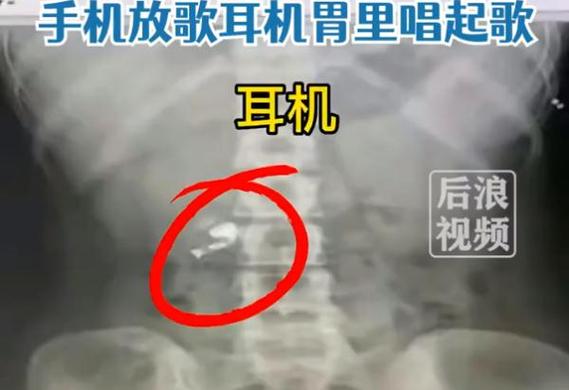 人吃了蓝牙耳机会拉出来吗图标