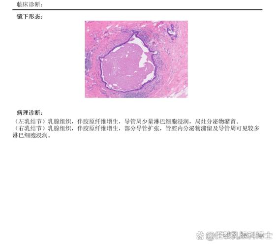 病理AUS是良性还是恶性图标