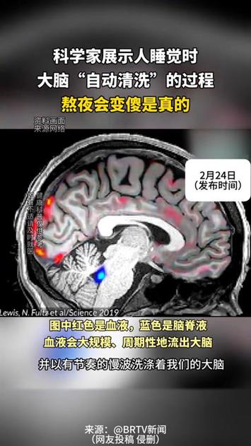清洗大脑破解版