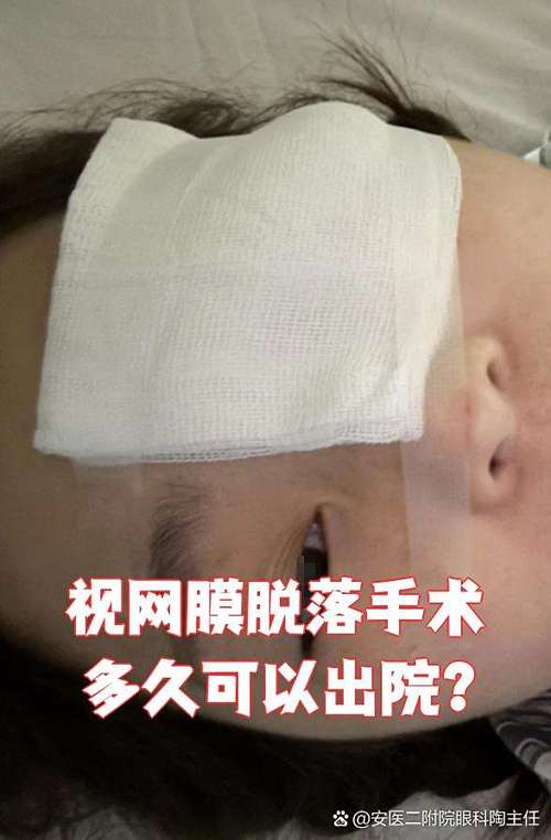 视网膜脱落手术做完需要多久出院图标