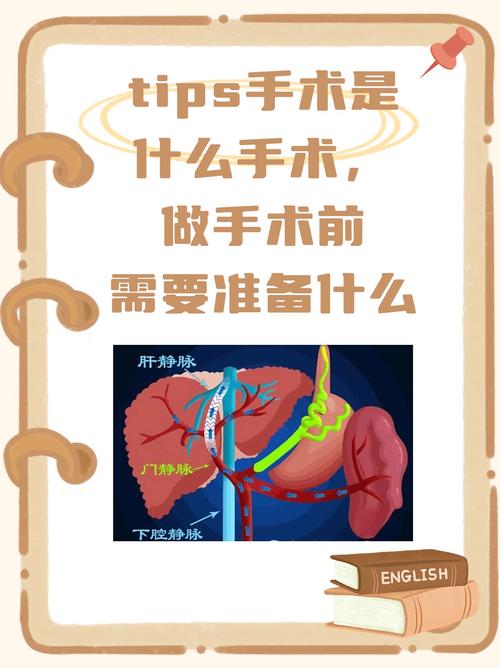 sics手术全称叫什么图标