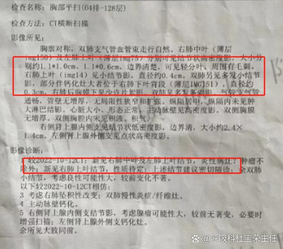 肺结节22x18mm严重吗截图