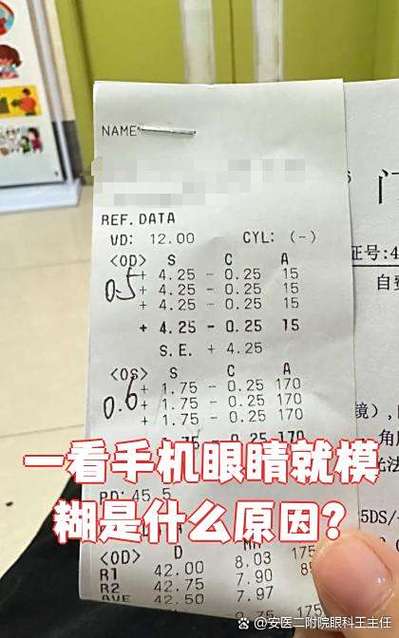 眼睛一看手机就模糊怎么回事图标