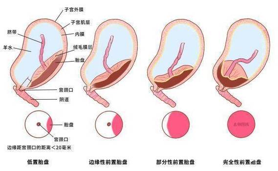 子宫极限截图