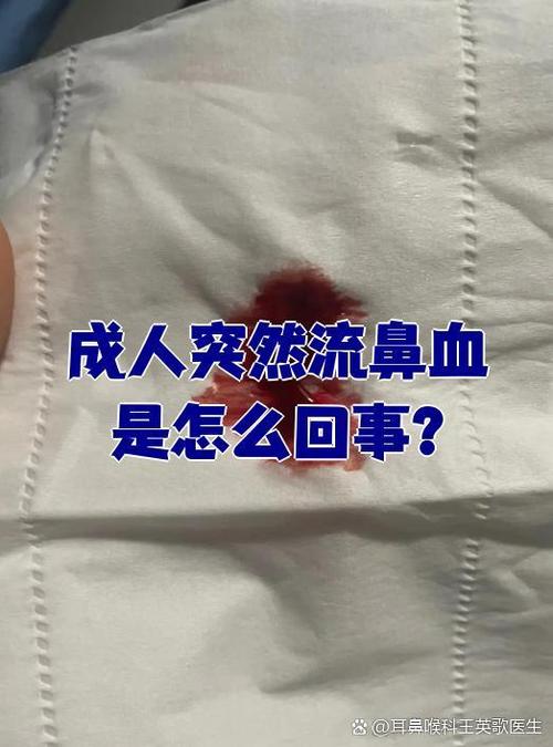 成人偶尔流鼻血正常吗图标
