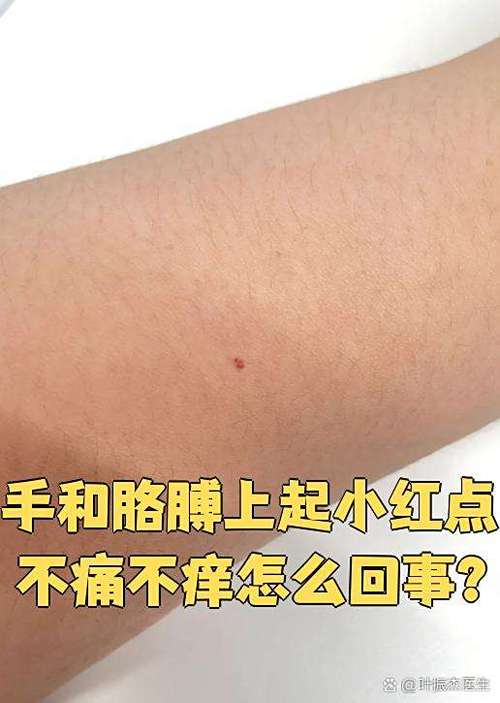 眼白出现红点