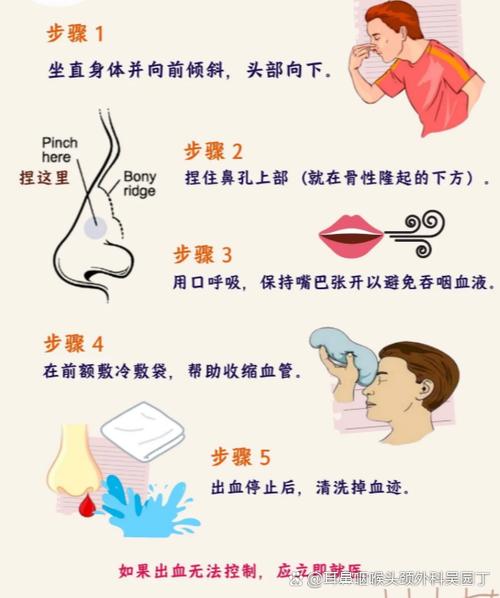 流鼻血是身体哪里出现问题,突然流鼻血什么原因图标