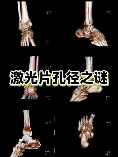 苹果7p底部的两排小孔图标