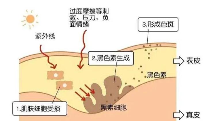 皮肤黑原因图标