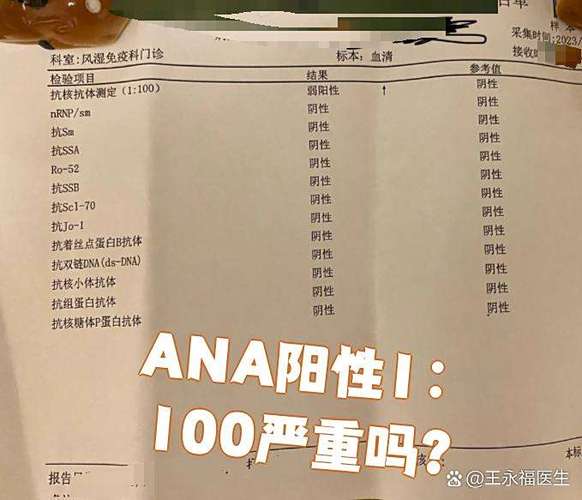 ana阴性好还是阳性好图标