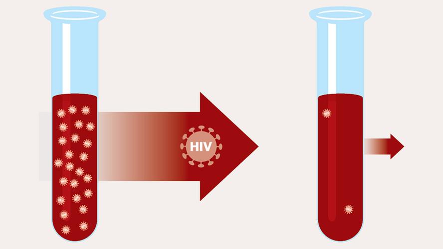 hiv病毒载量为0图标