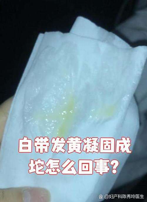 白带发黄发稠