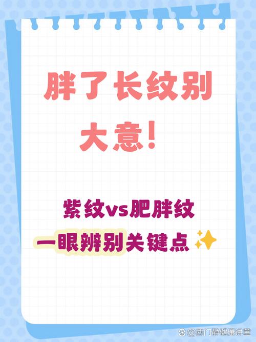 腿上紫色条纹图片图标