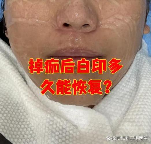 白色疤痕和红色疤痕的区别图标