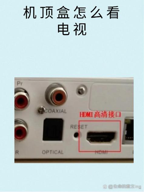 机顶盒如何连接电脑图标